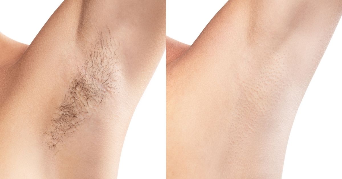 Does Armpit Hair Cause Sweat? | Exploring the Link